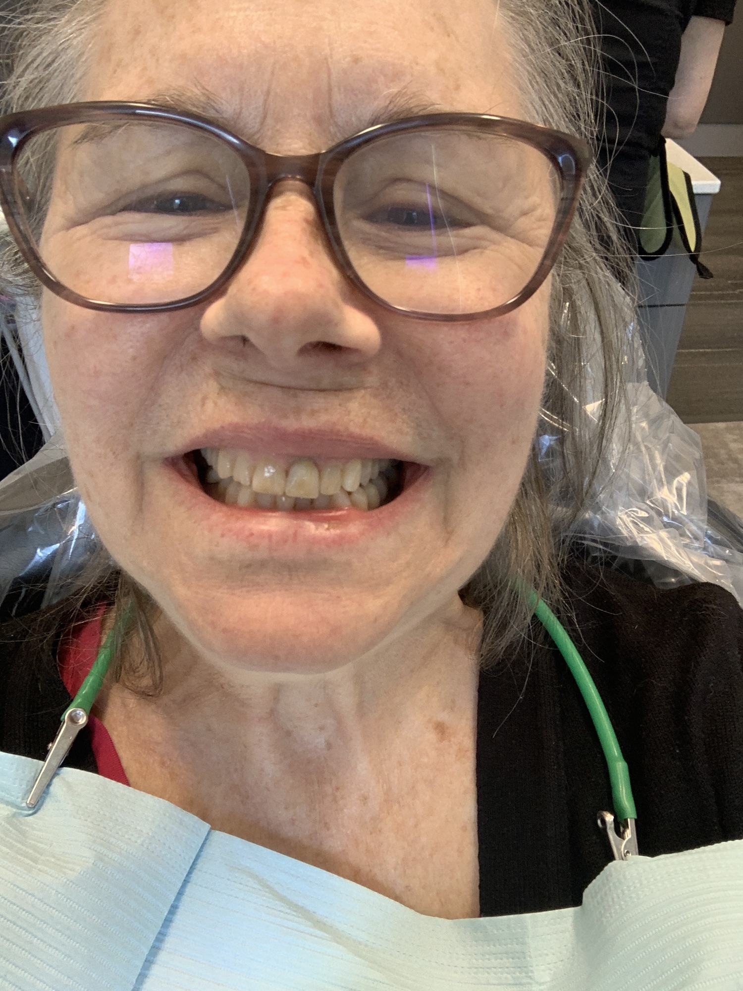 Tooth | Pattern and Outrage : Dee Mallon